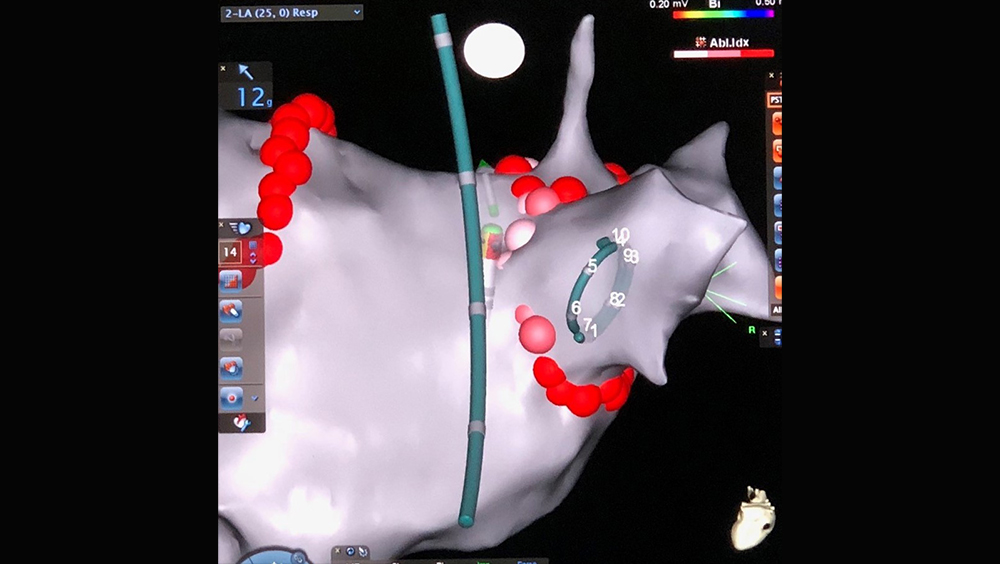 CIRCA S-CATH™ M | CIRCAScientific